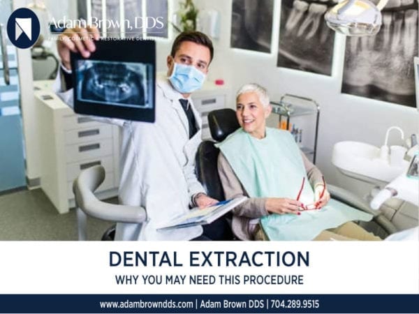 Tooth Extraction Explained at Carolina's Dental Choice - Adam Brown ...