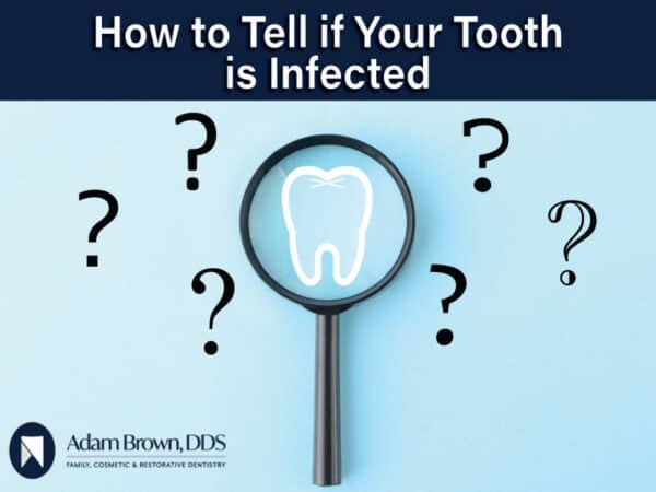 How to Tell if Your Tooth is Infected - Adam Brown Dentistry - Monroe ...